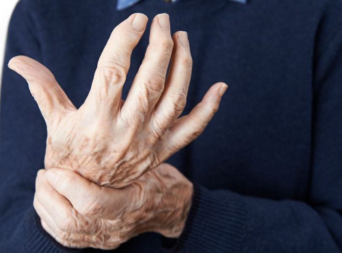 Homeopathic Help For Arthritis | Homeopathy Plus