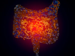 Homeopathy For Ulcerative Colitis | Homeopathy Plus