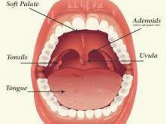 Remedies For Enlarged Adenoids | Homeopathy Plus